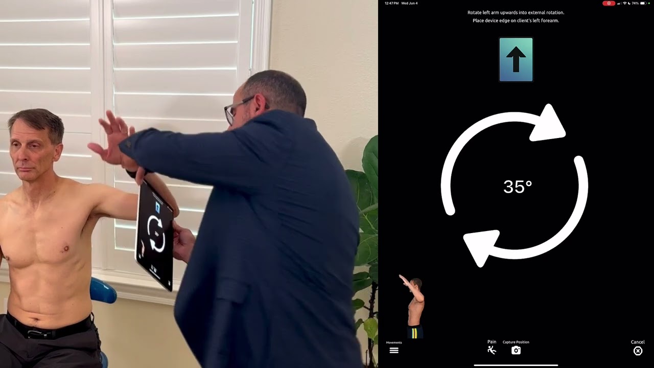 PostureScreen Shoulder ROM (Single Arm Tutorial)