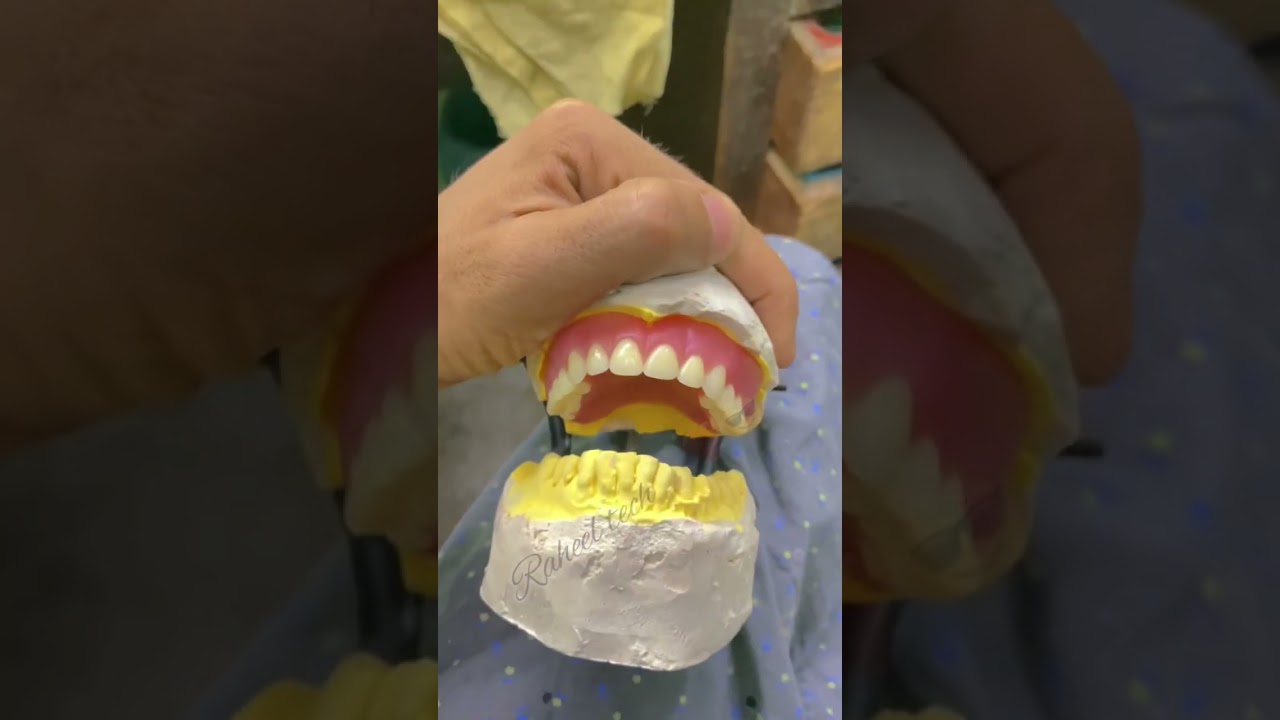 Subscribe krdena 🫡❤️ #dentallab #teeth #dentalclinic #dentist #viralvideo #fyp #foryou #foryoupage
