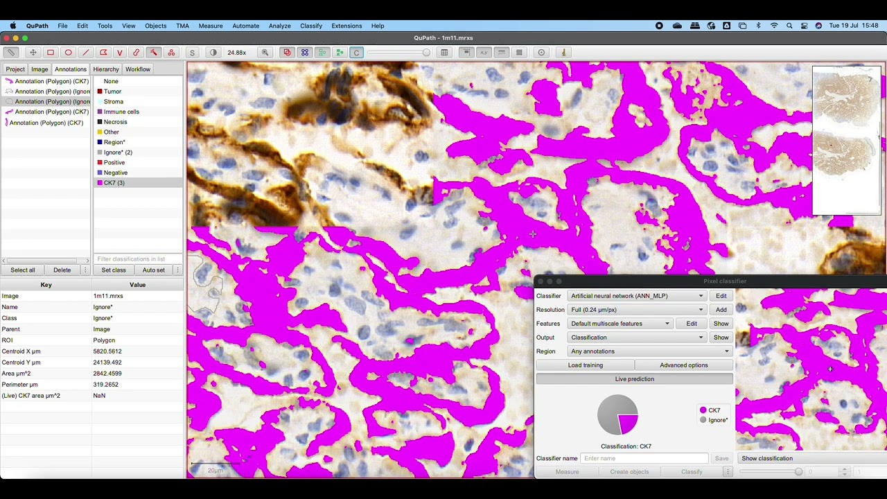 Training a Pixel Classifier in Qupath