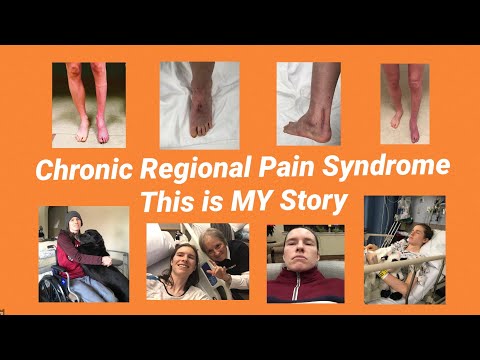 My CRPS Story