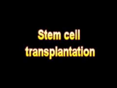 What Is The Definition Of Stem cell transplantation Medical School Terminology Dictionary