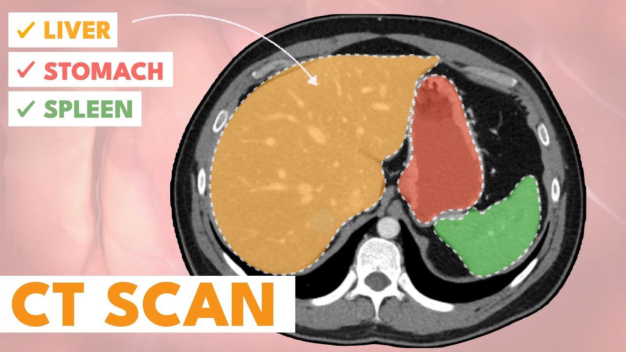How to read a CT scan (2/2) | A beginner's guide