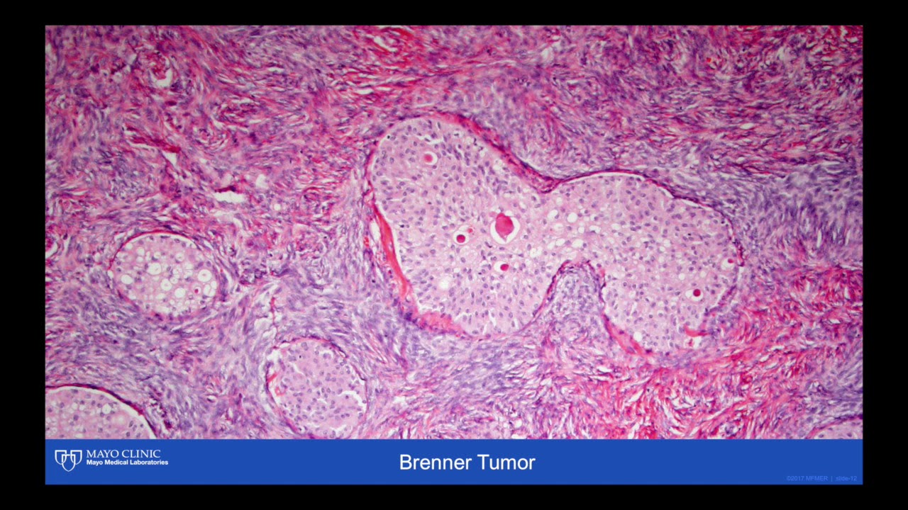 Cases with Dr  Keeney: Case #2