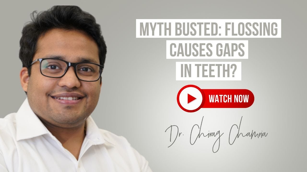 Myth Busted: Flossing causes Gaps in teeth? Dentistry Insights by Dr Chirag Chamria