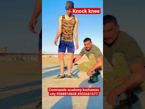 Knock knee problems || army medical test live
