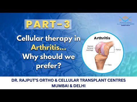 No More Knee Surgery? Dr. B. S. Rajput Reveals the Truth About Arthritis & Cellular Therapy! PART-3