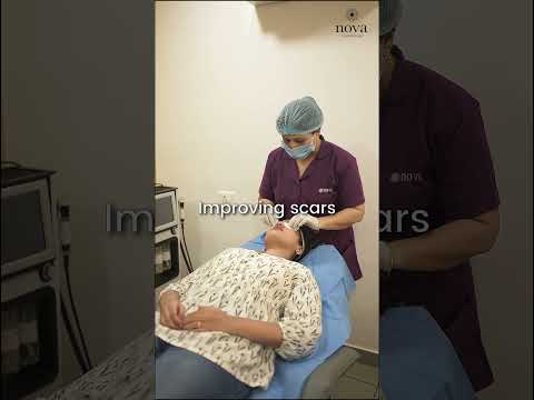 Acne Solution | Nova Cosmetology