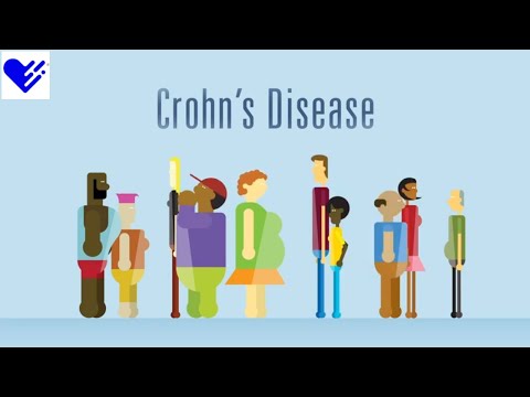 6 Food Facts for Crohn's Disease | Healthgrades