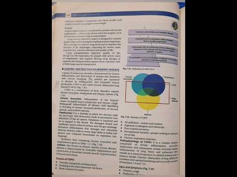 definition, causes, sing-symptoms, management, complications of COPD