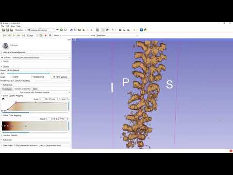 Ultrasound 3D reconstruction - Support - 3D Slicer Community