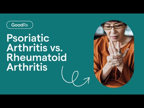 Psoriatic Arthritis vs Rheumatoid Arthritis: 5 Major Differences | GoodRx