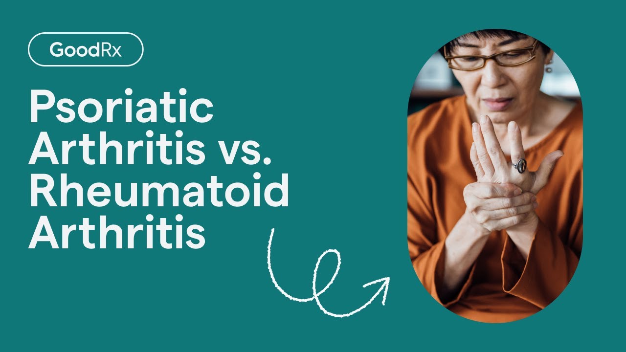 Psoriatic Arthritis vs Rheumatoid Arthritis: 5 Major Differences | GoodRx