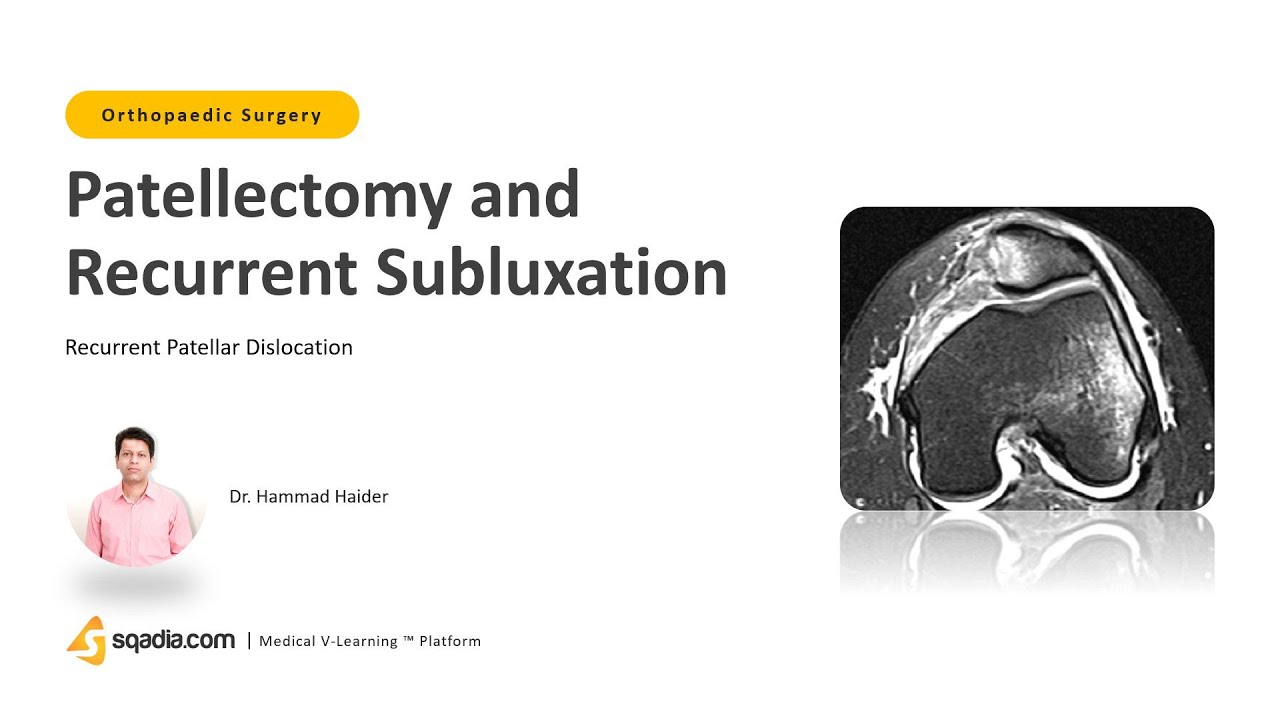 Recurrent Patellar Dislocation | Patellectomy and Recurrent Subluxation