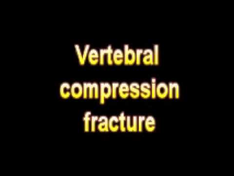 What Is The Definition Of Vertebral compression fracture