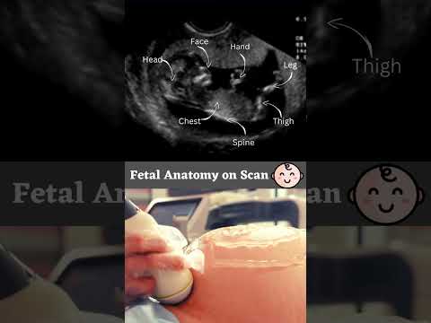 Fetal Anatomy on Scan #shorts #fetus #pregnancy