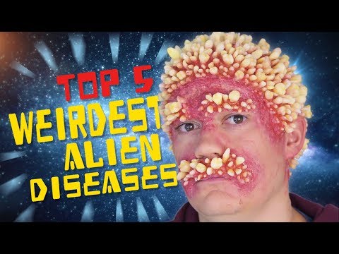 Die Top 5 der bizarrsten Alien-Krankheiten bei Seitvertreib