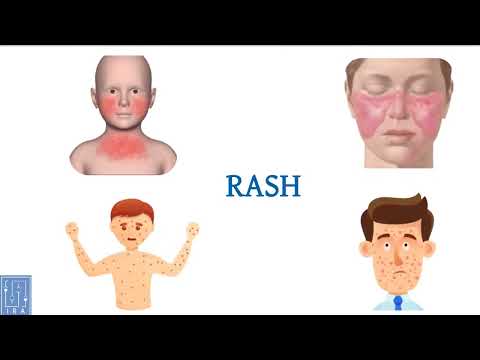 Everything you need to know about Rheumatology