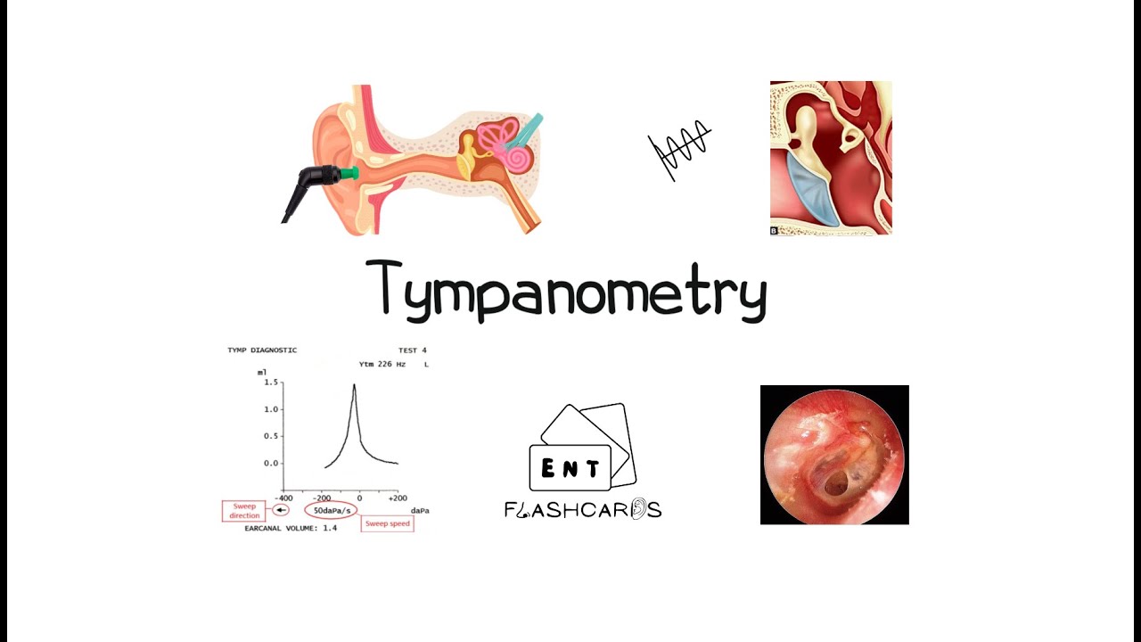 Tympanometry - An Overview