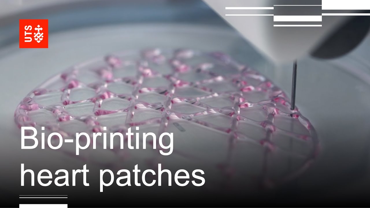 Revolutionising heart repair with stem cell patches