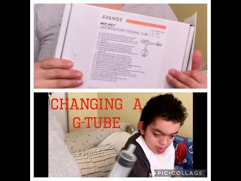 How to change a Gastrostomy Tube ( G-tube )
