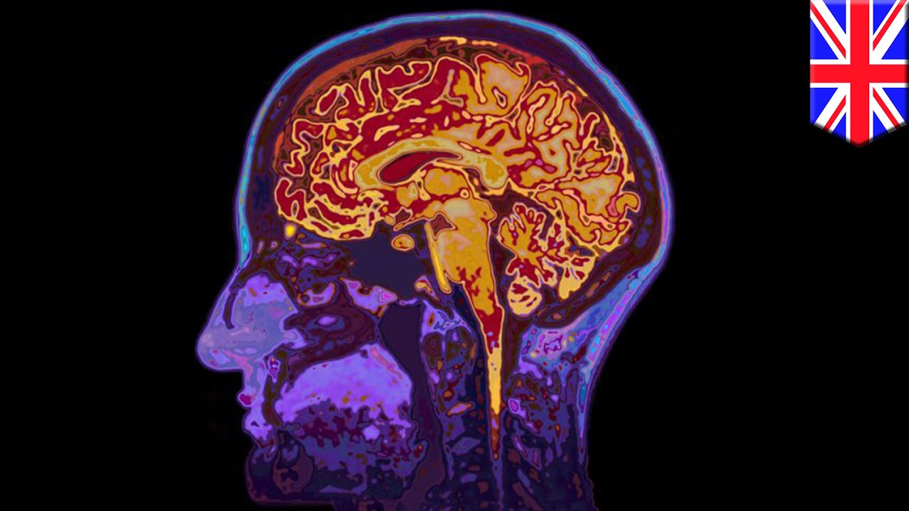 UK scientists develop gene therapy to treat early stages of Alzheimer’s disease - TomoNews