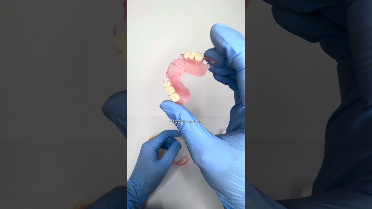 The Best Tooth Replacement Solution: Flexible Partial Dentures by Revived Smiles