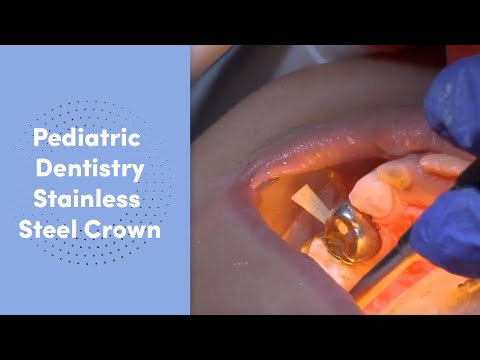 Pediatric Dentistry Procedure - Stainless Steel Crown with Dr. Ana