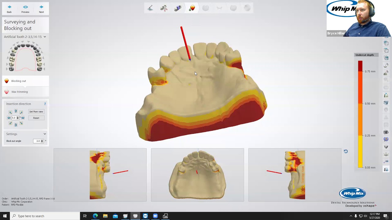 Digital Dentistry Training Series: RPD Flexible Design