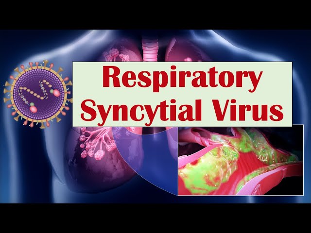 Why is RSV so bad this year? Symptoms, how to treat, transmission, and ...