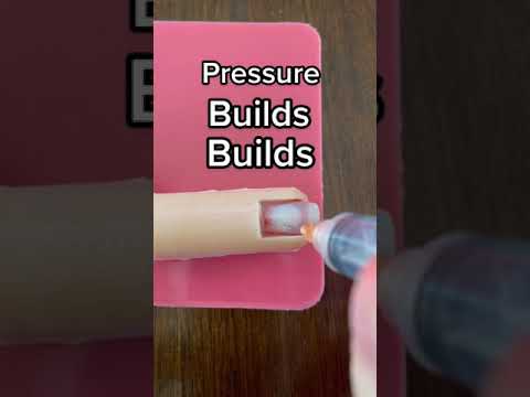 Smashed your finger