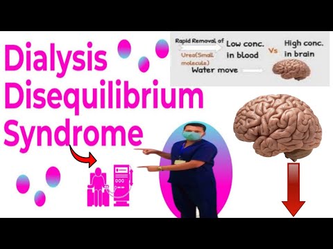 What is Dialysis Disequilibrium syndrome {DDS} | Prescription of first dialysis #dialysis #theory
