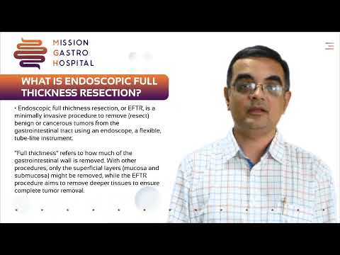 Endoscopic Full Thickness Resection: Who Qualifies for this Cutting-Edge Procedure? Dr .Pratin Bhatt