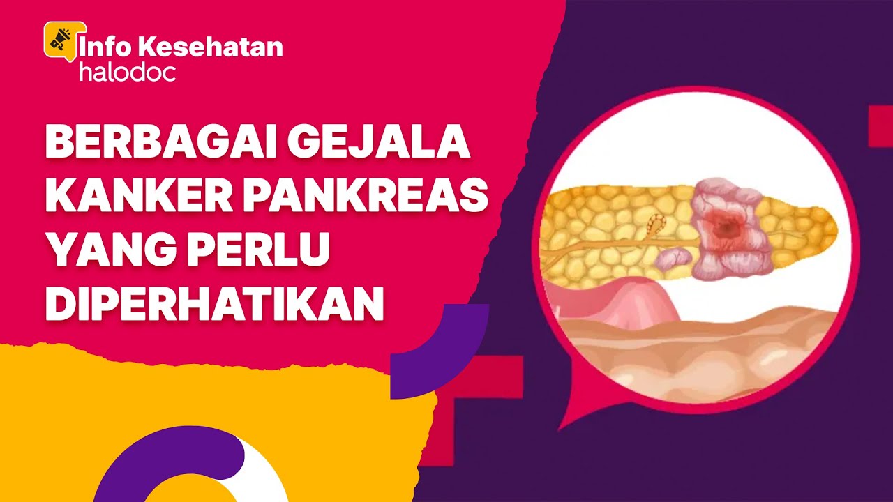 Ini Gejala dan Penyebab Kanker Pankreas