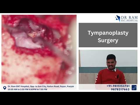 ???? Expert Tympanoplasty Surgery at Dr. Ram ENT Hospital ????
