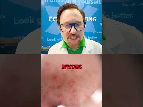 A NIGHTMARE For Dermatologists... #shorts #skincare #dermatology