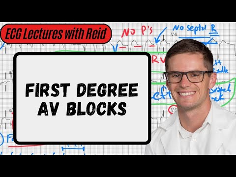 First Degree AV Block | Day 4 ECG Challenge