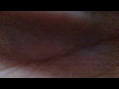 Stinky Feet