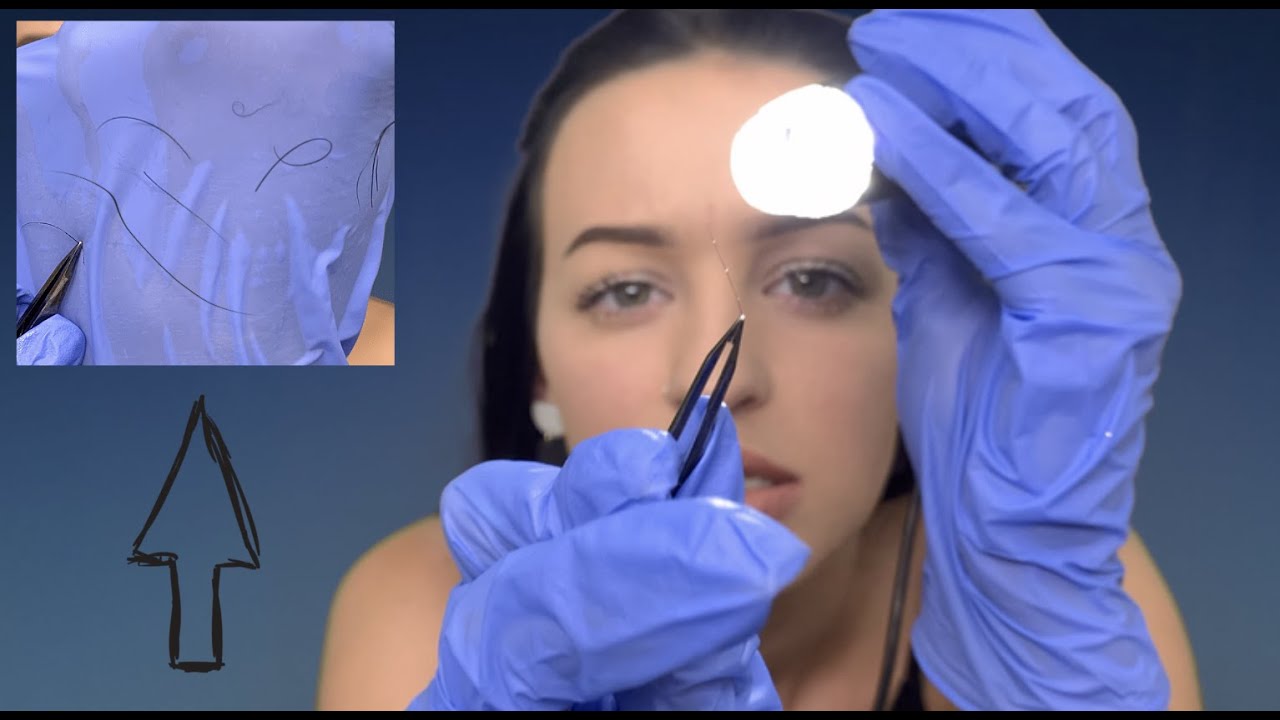 [ASMR] Removing Your LONG Ingrown Facial Hairs RP