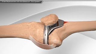 Patient Education in Orthopedic Surgery – OrthoIllustrated