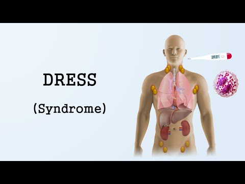 DRESS Syndrome (Drug Reaction with Eosinophilia and Systemic Symptoms)