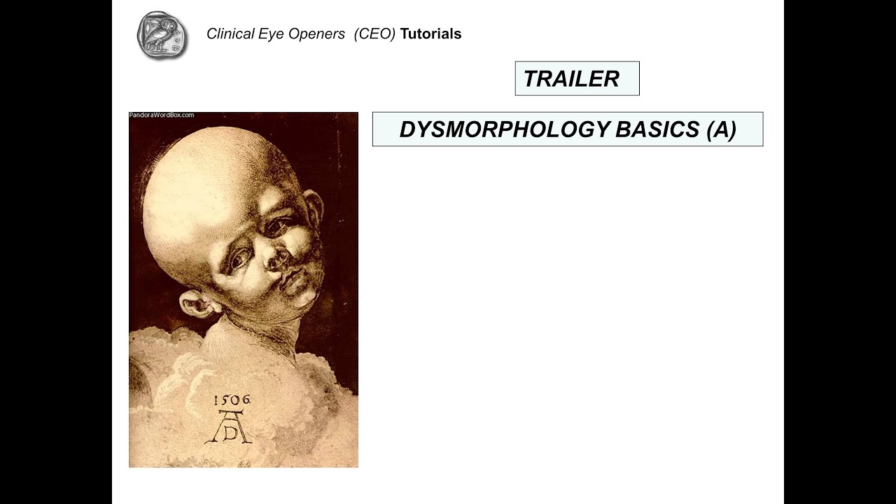 Dysmorphology Basics trailer