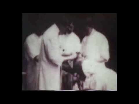 Primera filmación de una cirugía en el Mundo. Dr Alejandro Posadas - Argentina