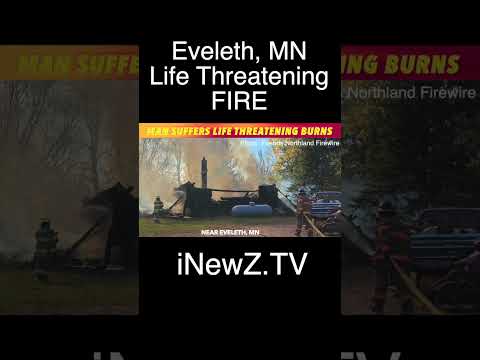 Rural Eveleth, MN Man Suffers Life Threatening Burns