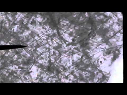 Areolar CT.mov