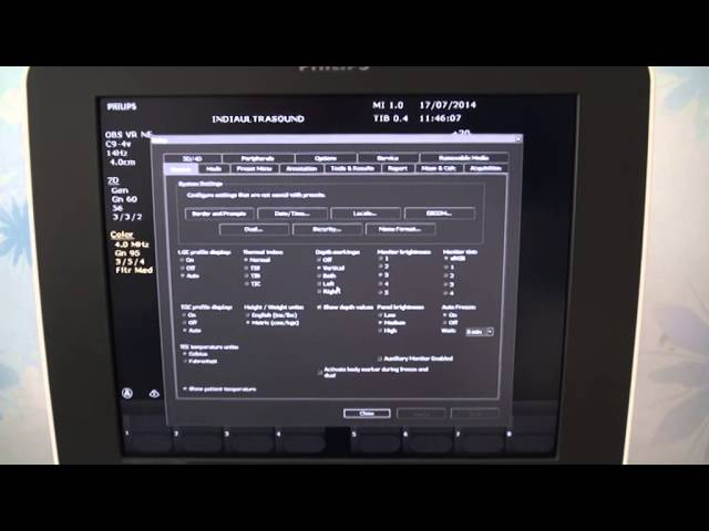 Philips Ultrasound Machine - Philips Clearvue 550 Ultrasound Machine ...
