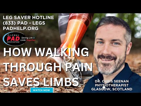 Walking as Medicine: The Counterintuitive Yet Powerful Treatment for Peripheral Artery Disease