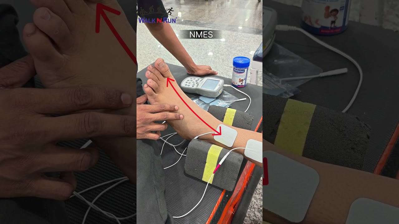 Neuromuscular electrical stimulation for faster recovery. #physiotherapist #physio