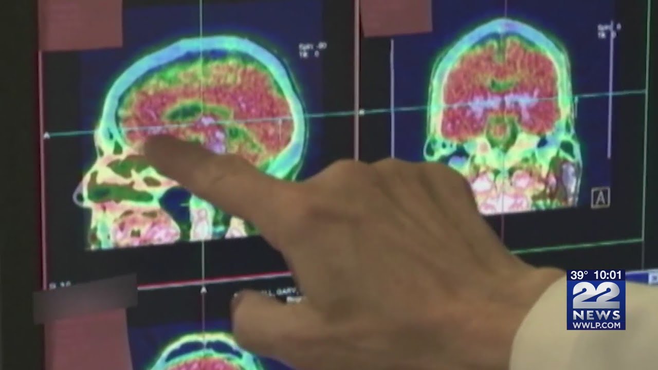 March is brain injury awareness month: What is a concussion?