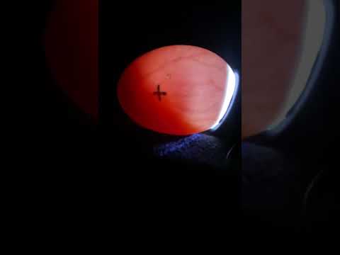 Candling duck egg around day 15