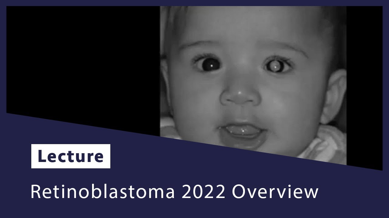 Retinoblastoma 2022 Overview
